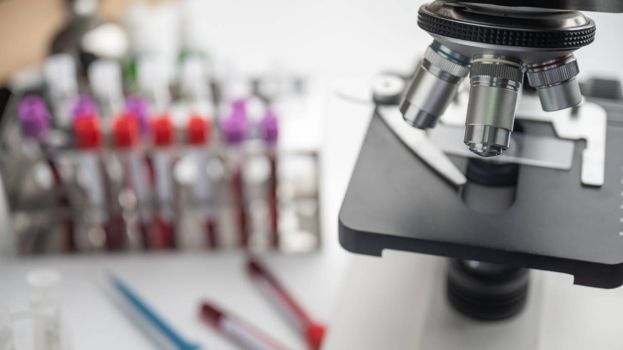 Βιοχημικές Εξετάσεις Αίματος: Τι Δείχνουν | Doctor Home Care